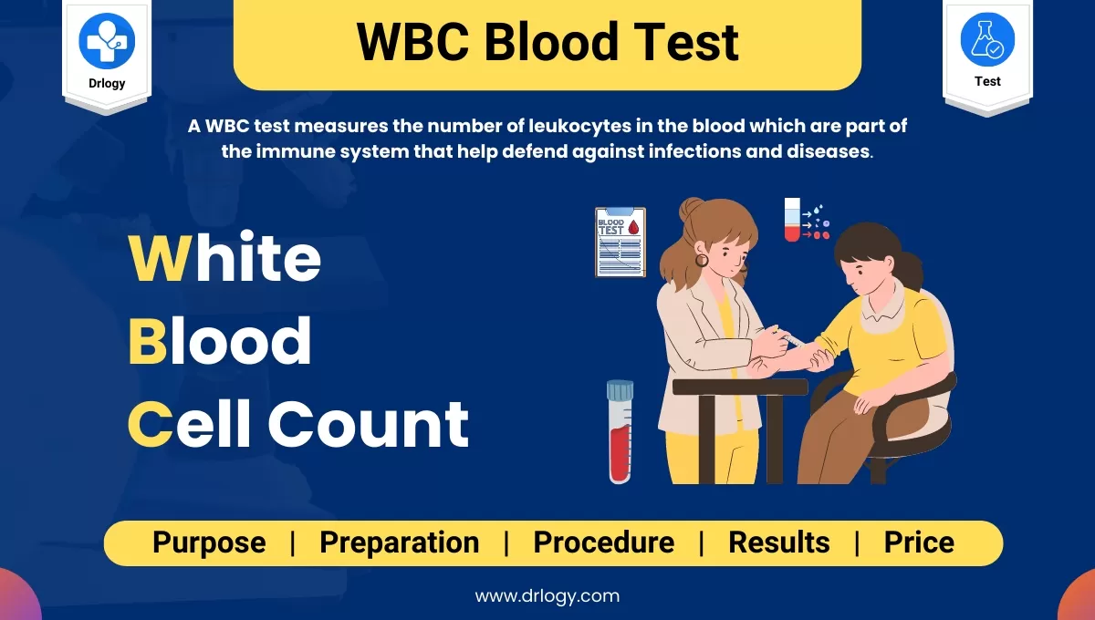 Why Is A WBC Blood Test Done 